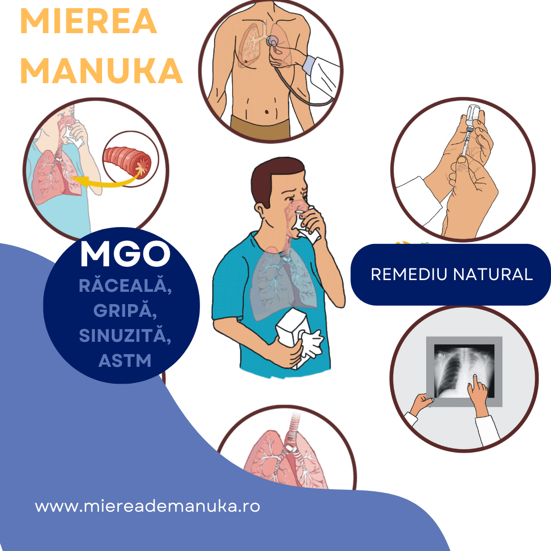 Mierea de Manuka pentru tratarea problemelor respiratorii: Un remediu ...