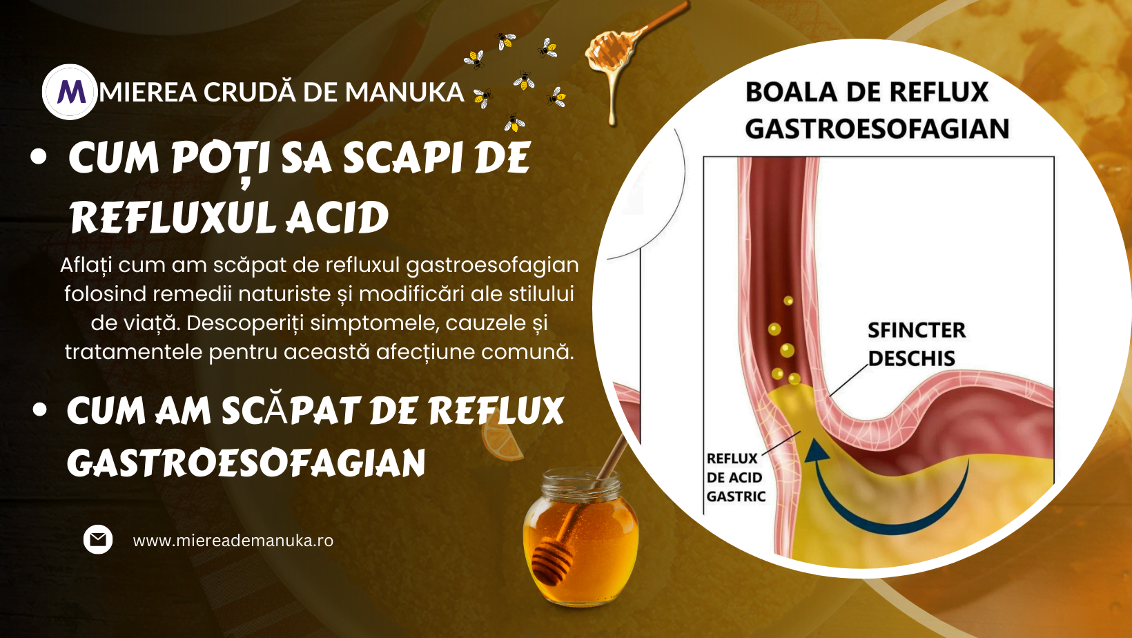 Cum am scapat de reflux gastroesofagian ? - Beneficiile Naturii în Cea ...